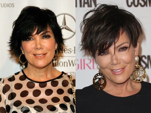 I Kardashian prima e dopo (parecchia) chirurgia estetica - Grazia.it