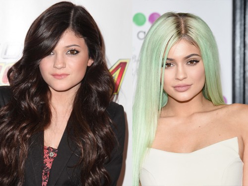 I Kardashian prima e dopo (parecchia) chirurgia estetica - Grazia.it